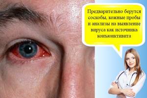 Хлоргексидин для глаз, можно ли промывать или капать им глаза