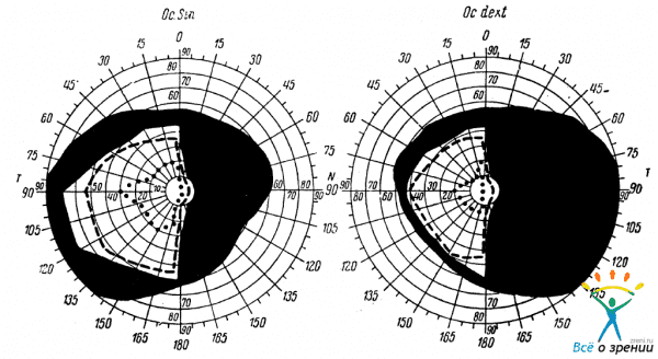 Hemianopsia of the eye: types, treatment, causes and prevention