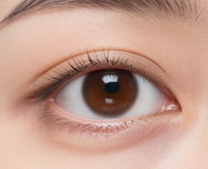 Lower eyelid hernia - choice of treatment method